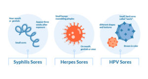 STD Sores | Priority STD